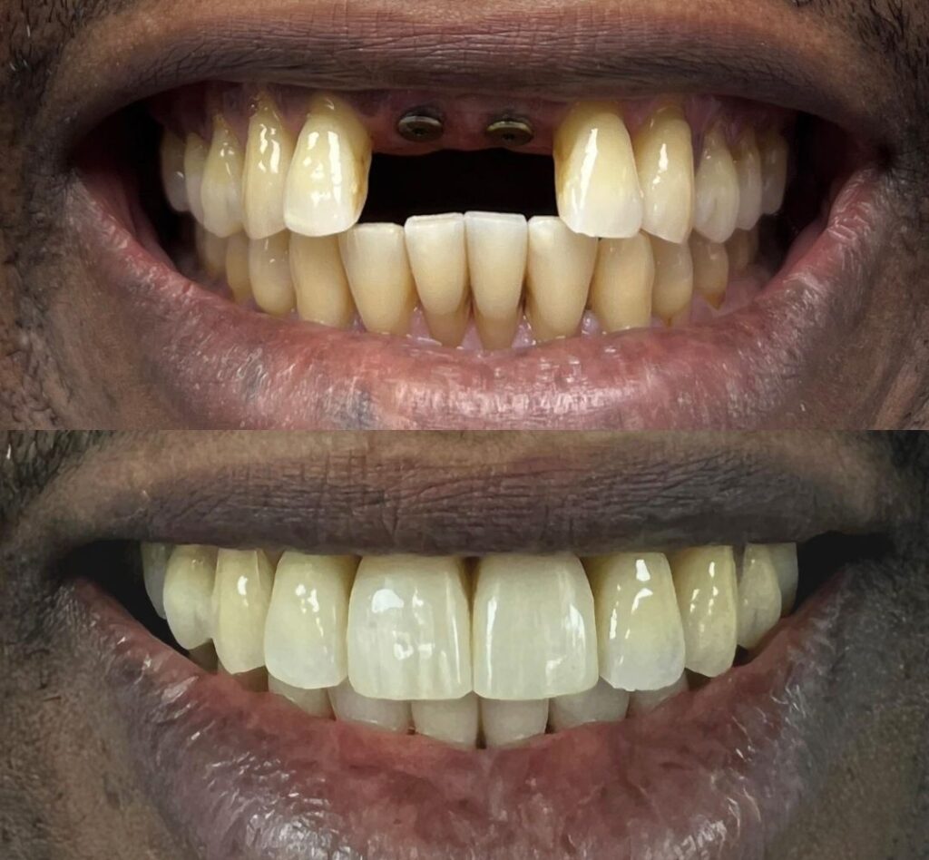 Complete Smiles – UK
